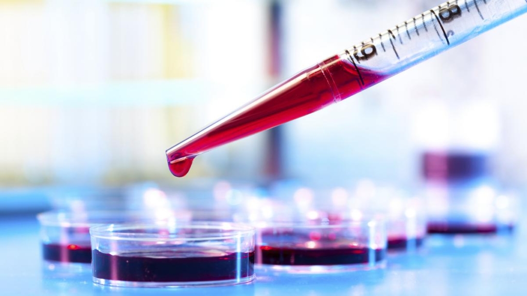 Gene & Cell Therapy - Research Triangle Regional Partnership